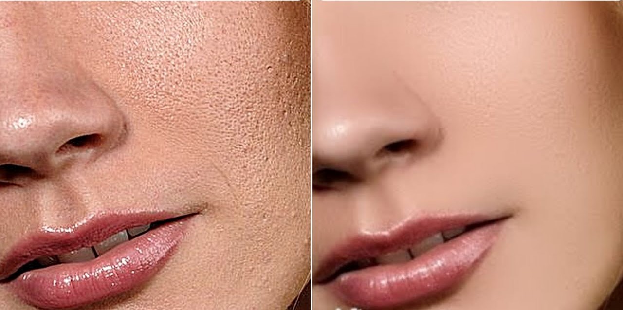 रूखी त्वचा से छुटकारा पाने का घरेलू उपाय | Home remedies to get rid of ...